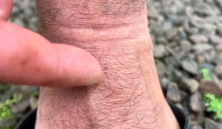 O mosquito maruim é o vetor da febre Oropouche